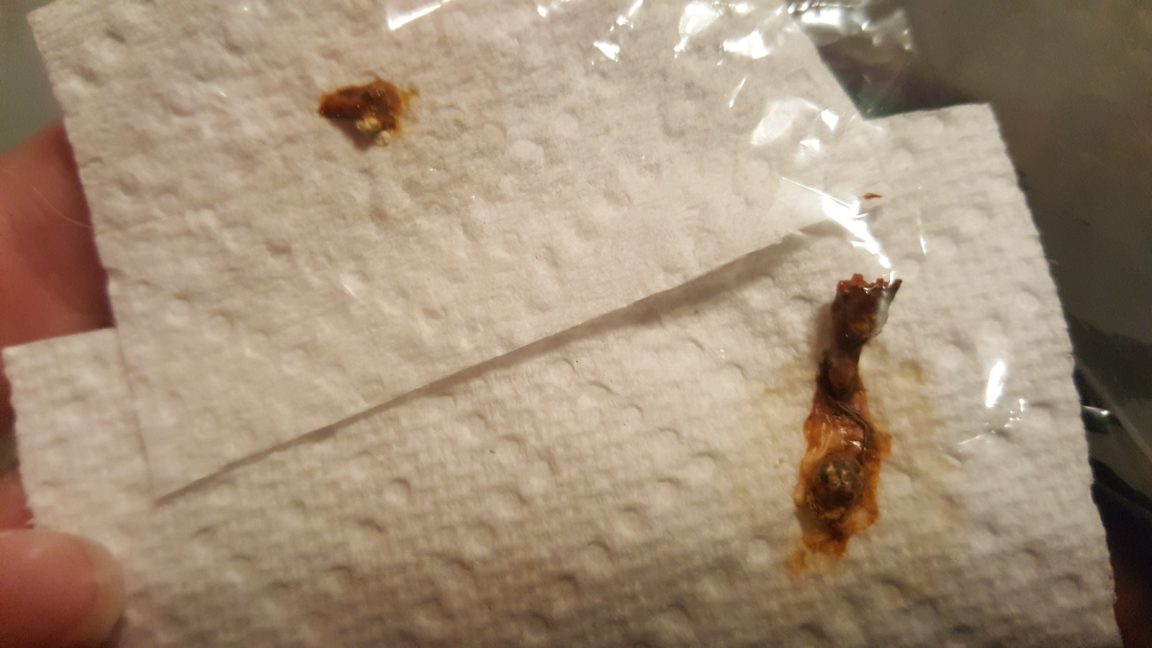 What does blood in poo look like?