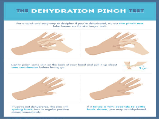 How can you tell if your dehydrated?