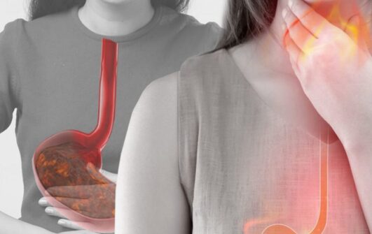 How do you cure GERD permanently?