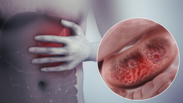 What are the symptoms of stomach shrinking?
