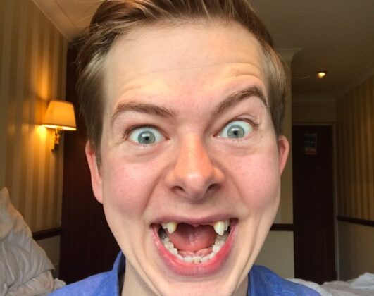 What is a person without teeth called?